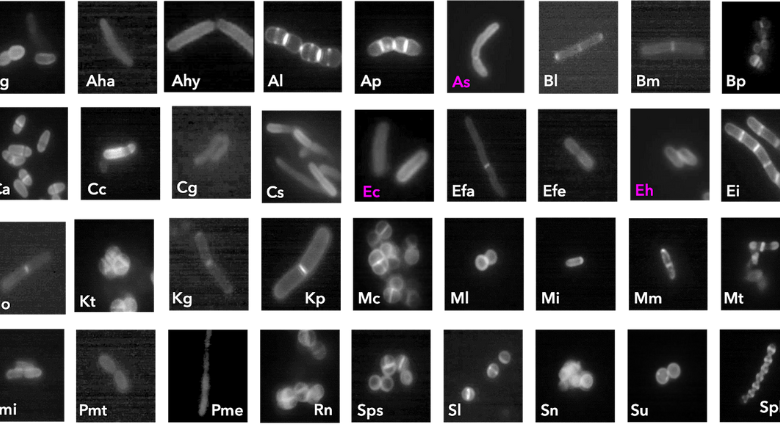 New Detection Tools for Clostridium Perfringens, Total Viable Bacteria ...